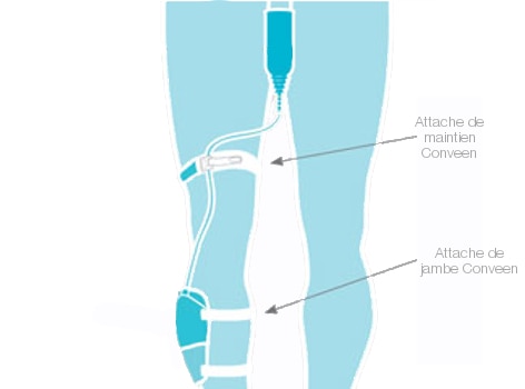 Fuites urinaires masculines, testez Conveen - Coloplast